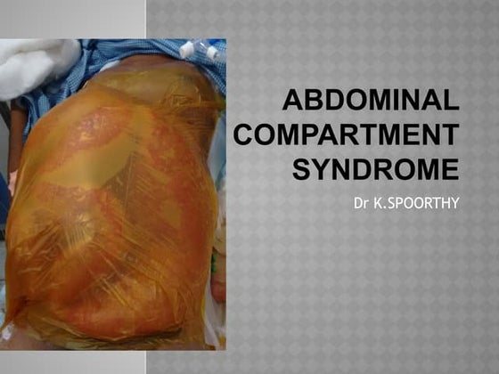 Abdominal compartment syndrome powerpoint slides | PPT
