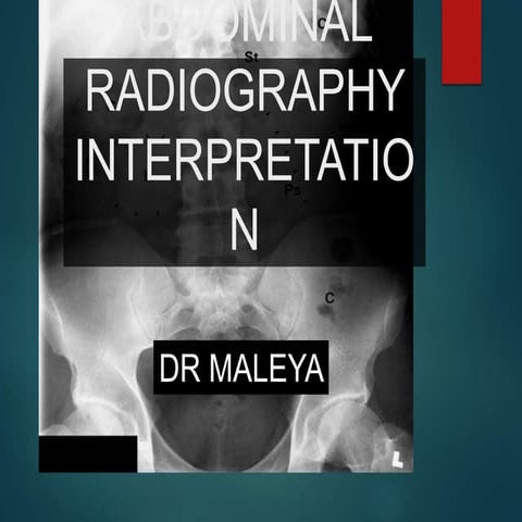 ABDOMINAL RADIOGRAPHY.pptx.pptx