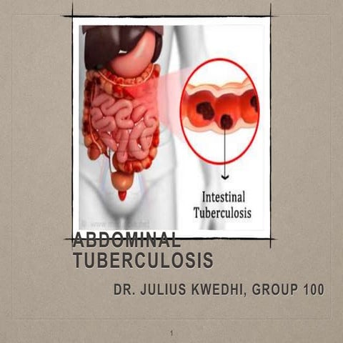 Abdominal Tuberculosis - Dr. Julius King Kwedhi | PPTX