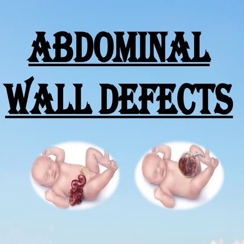 abdominal wall defect in child health nursing | PPTX