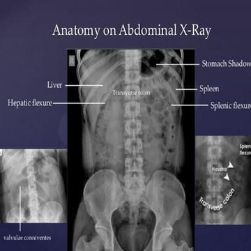 Abdominal X ray | PDF