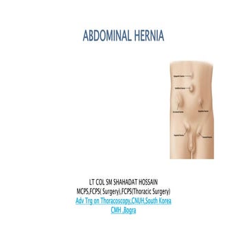Abdoninal hernia | PPTX