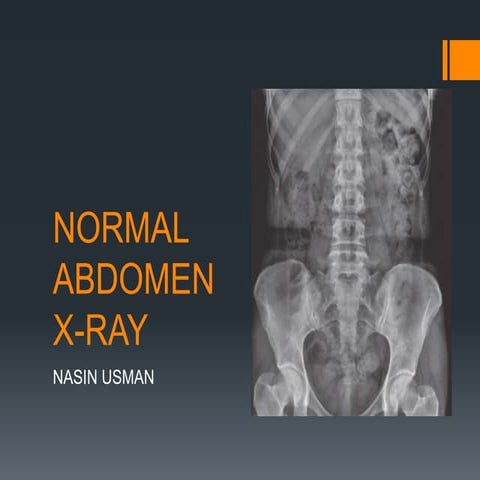 Abd xray | PPTX