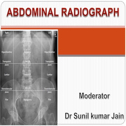 Abdomen radiography | PPT
