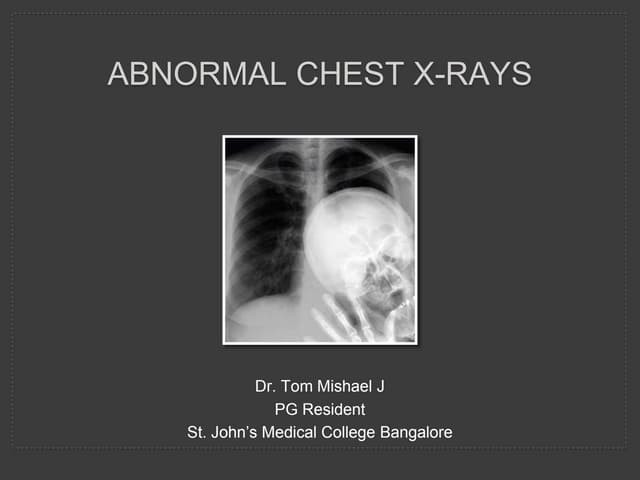 Chest X-ray interpretation (2017) | PPTX