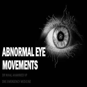 ABNORMAL EYE MOVEMENTS-SEEN IN OP PATIENTS.pptx