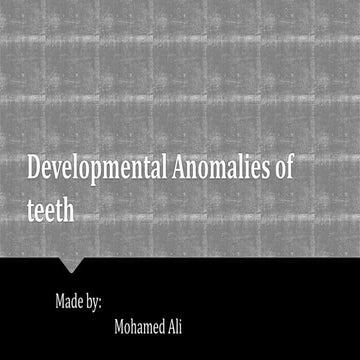 Abnormalities of teeth | PPTX
