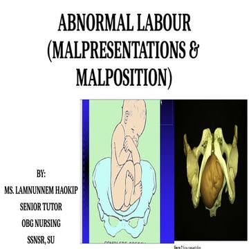 ABNORMAL LABOUR MALPRESENTATIONS & MALPOSITION (1) (1).pptx