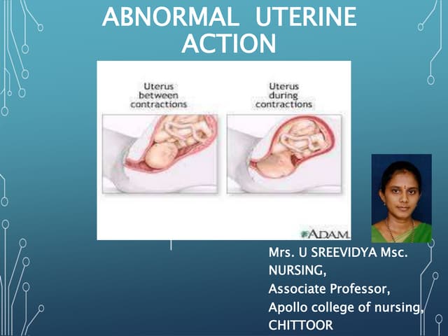 Uterine inertia | PPT