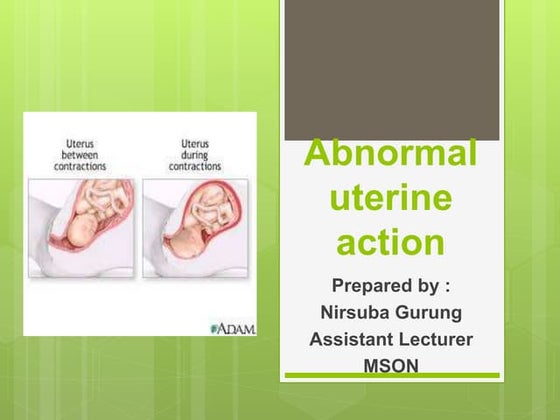 Uterine inertia | PPT | Pregnancy | Reproductive Health