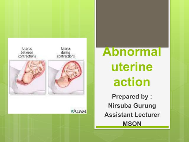 Uterine inertia | PPT