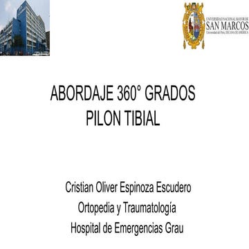 ABORDAJE 360° PILON TIBIAL TRAUMATOLOGIA .pptx