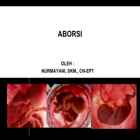 aborsi (kesadaran wanita) | PPT