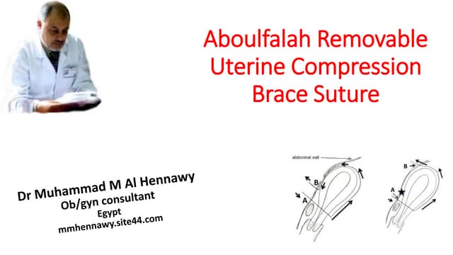 Principle of laparoscopic surgery | PPTX