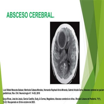 Absceso Cerebral; Diagnostico, Manejo y Complicaciones.pptx