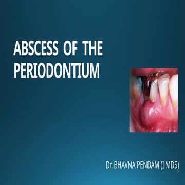 Periodontal abscess, abscess of periodontium | PPTX