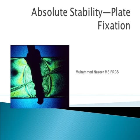 Plating principles in Orthopaedics | PPTX