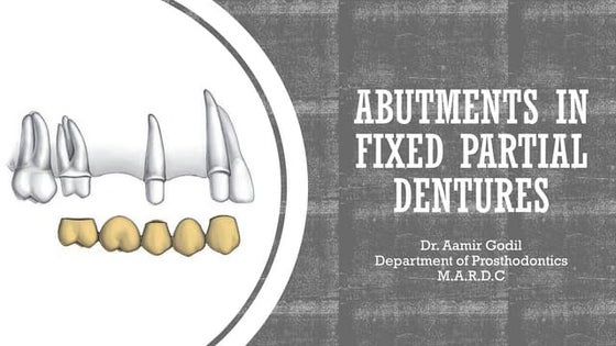 pontics in FPD (prosthodontics) | PPT