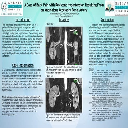 A case of back pain with resistant hypertension resulting from an ...