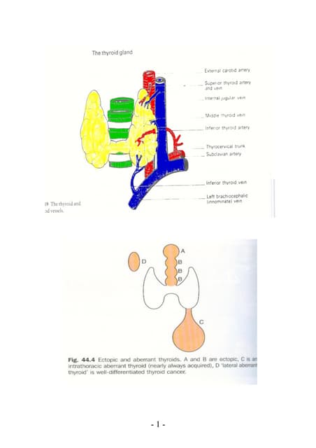 Multinodular goitre | PPT