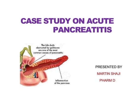 CASE PRESENTATION ON ACUTE PANCREATITIS | PPTX