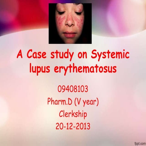 A case study on systemic lupus erythamatosus | PPTX