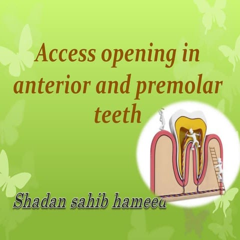 Access opening in anterior teeth | PDF