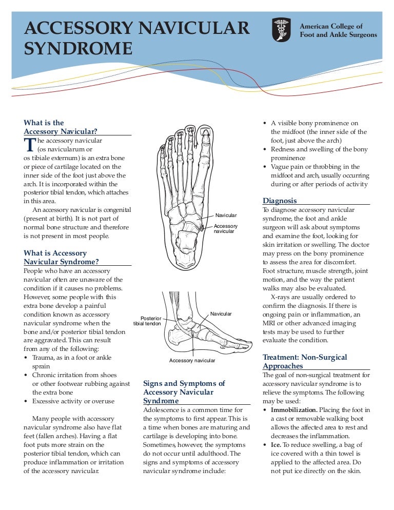 Accessory Navicular Syndrome