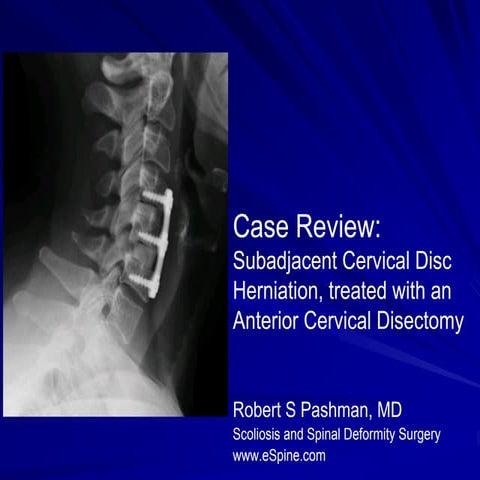 Case Review #9: 40 year old female treated with a Bryan Cervical Disc | PDF