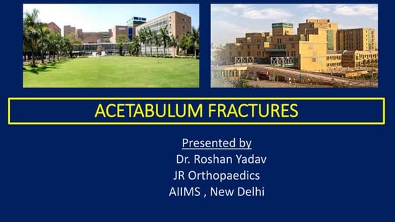 Monteggia fracture & galeazzi fracture | PPT