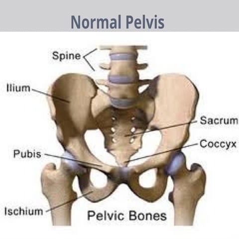 Acetabulum, Pelvis, Hip and femur ortho.pptx