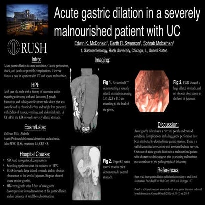 ACG: American College of Gastroenterology Poster - Acute Gastric Dilation | PDF | Digestive ...