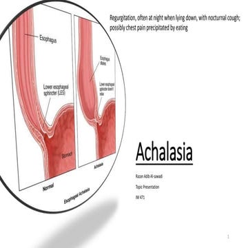 Achalasia razan alsawadi copy | PPTX
