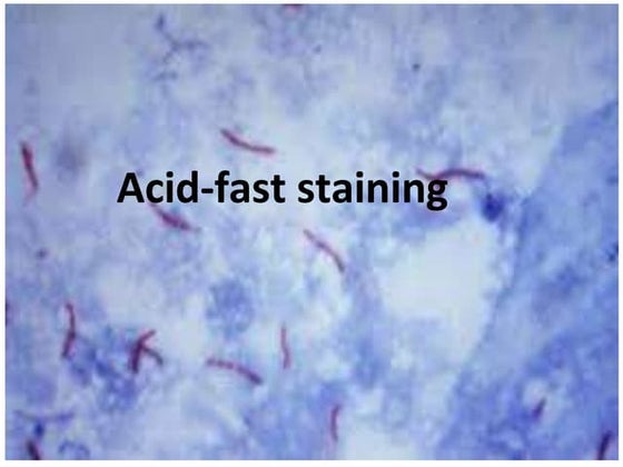 Ziehl-Neelsen n stain / Acid fast stain | PPTX | Alcoholic Beverages ...