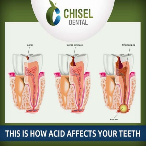 This is How Acid affects your Teeth | PPTX