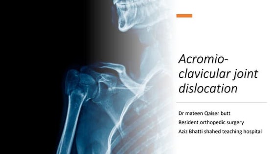 Reconstruction of Shoulder Separation and A.C. Dislocation | PPT