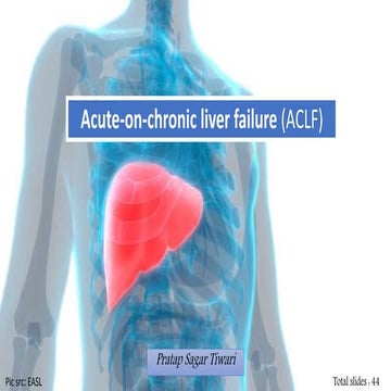 Acute on Chronic Liver Failure (ACLF) | PPTX