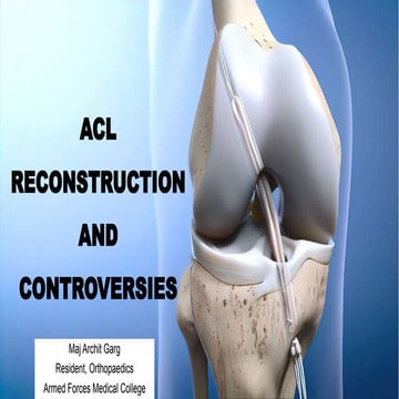 ACL RECONSTRUCTION AND CONTROVERSIES JOURNAL CLUB.pptx