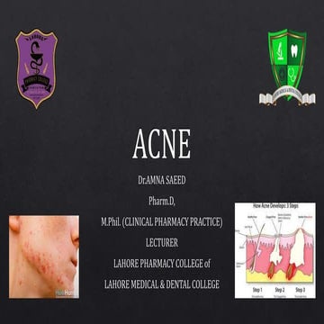 Acne (pimples) | PPT