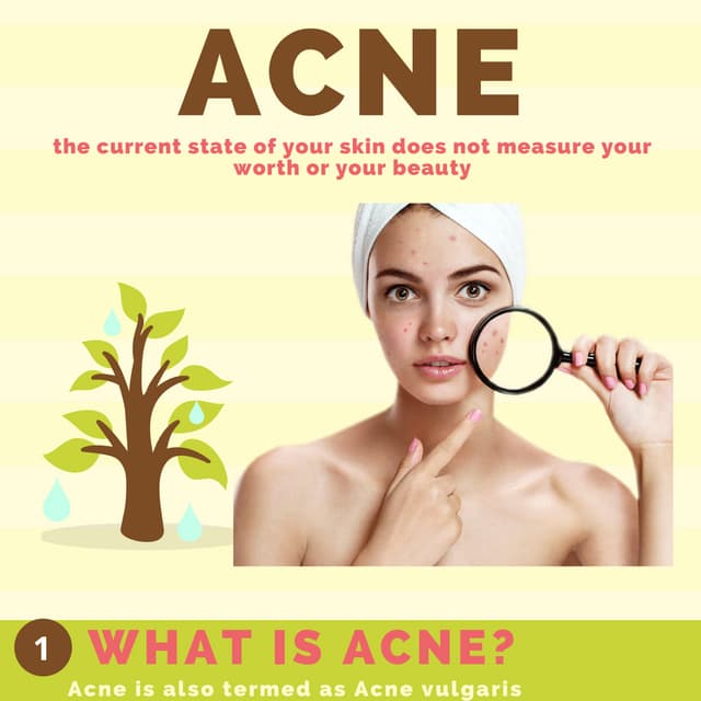 Acne | PDF