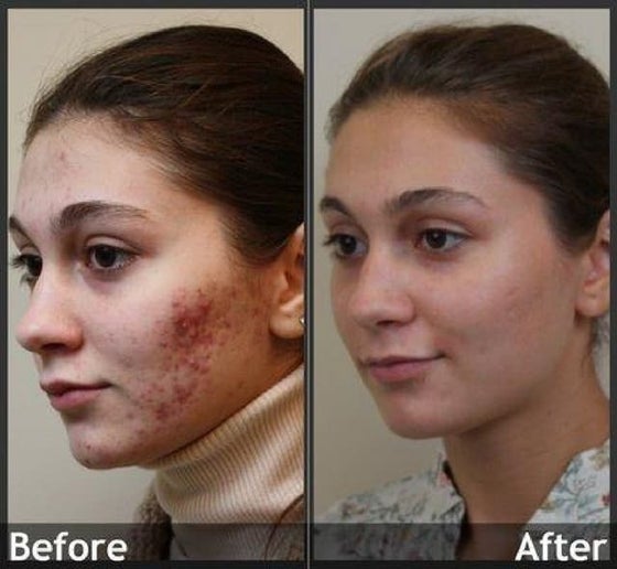 About Face Skin Care presentations