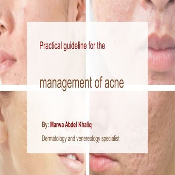 Practical guideline for the acne management | PPTX