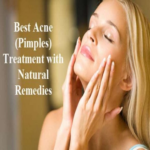 Acne & pimples home remedies treatment | PPTX