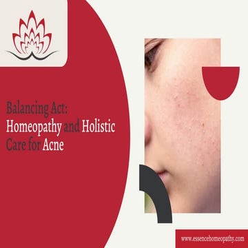 Balancing Act: Homeopathy and Holistic Care for Acne | Essence ...