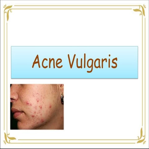 Acne vulgaris.pptx