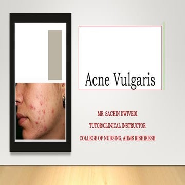 Acne | PPTX