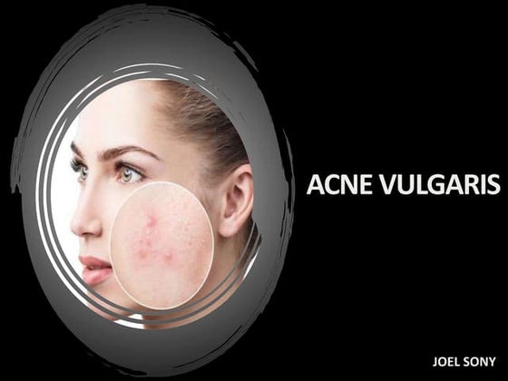 Bullous dermatoses and erythema multiformis | PPT