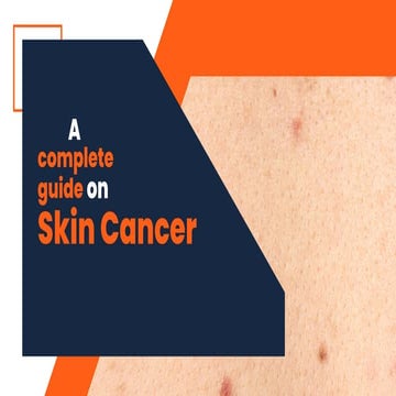 A complete guide on skin cancer.pdf