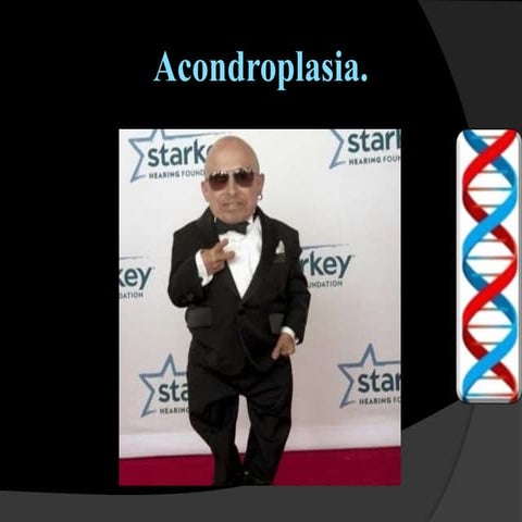 Acondroplasia | PPTX