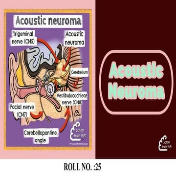 Verona Geographer Acoustic Neuroma [PDF] Pain. Part 7: Trigeminal ...